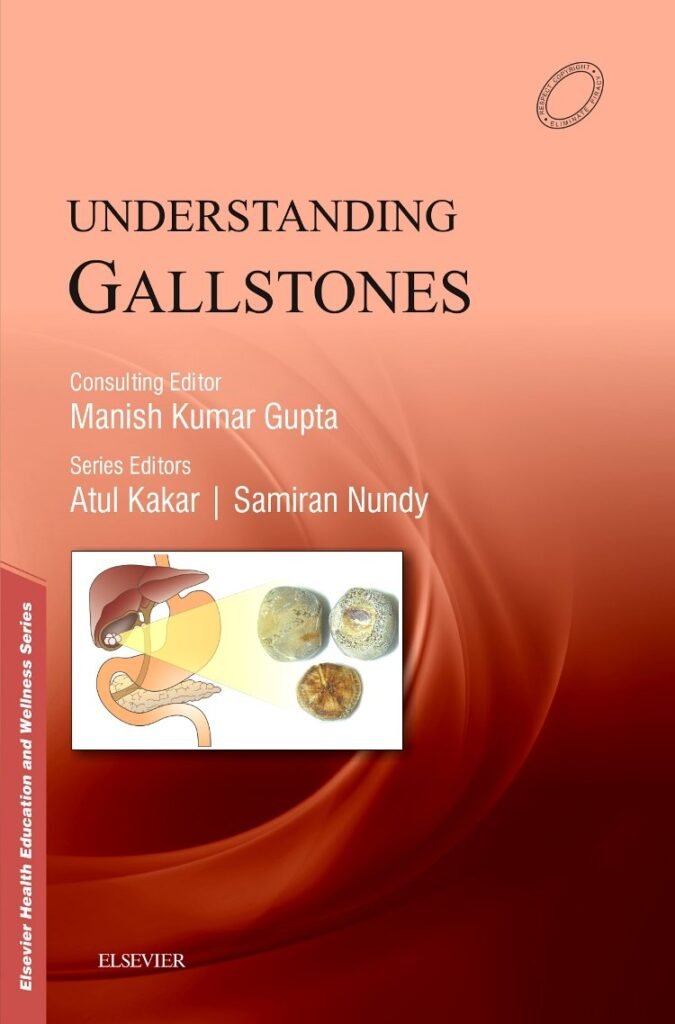 Understanding Gallstones by Atul Kakar - Drcart Understanding Gallstones